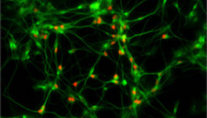 Finding a Cure at Project ALS: Research Matters